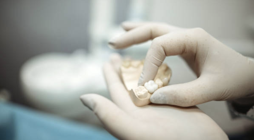 Exploring the Benefits of Tooth Replacement Surgery - Wellbeing Magazine