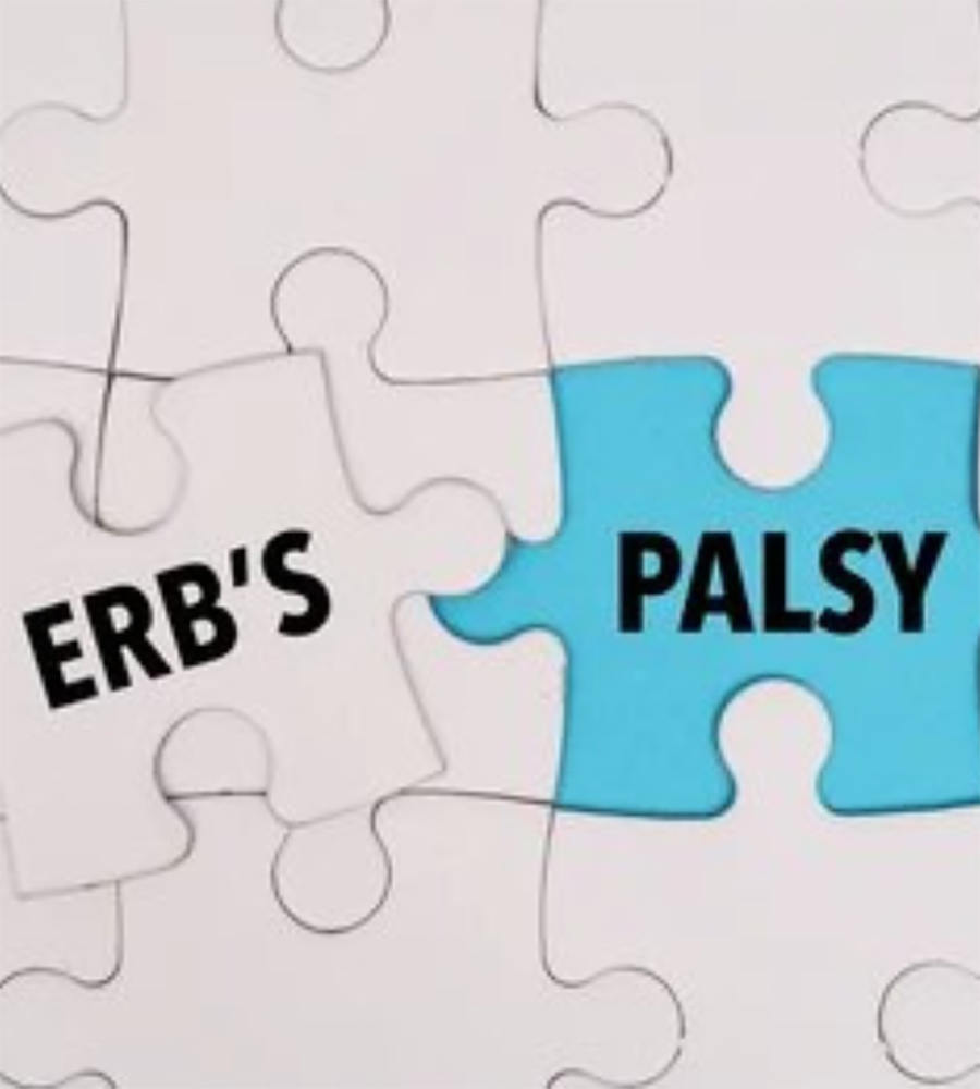 Erb's Palsy: Causes, Symptoms, and Treatment Options - Wellbeing Magazine