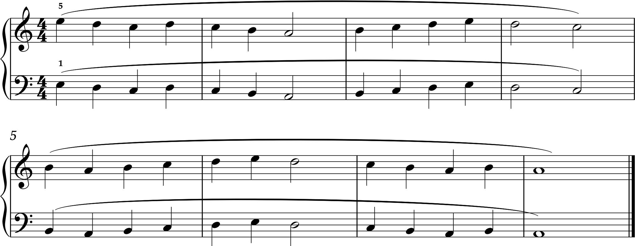 The Curious Piano Teachers Blog - Curious about arm alignment?