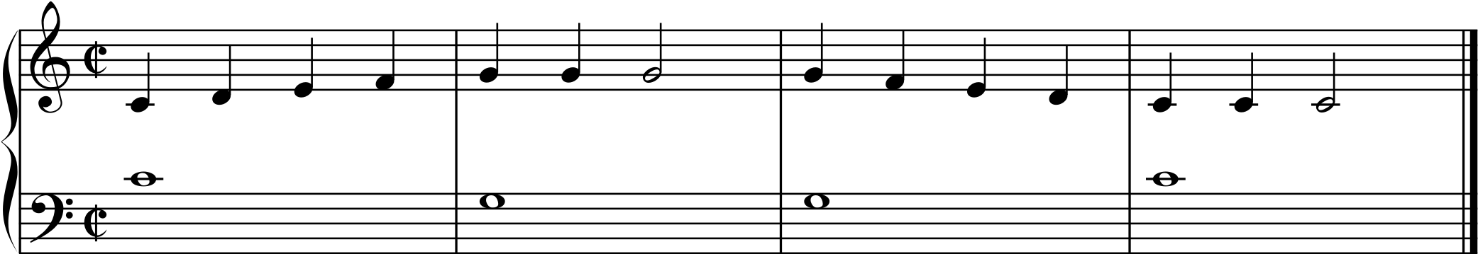 The Curious Piano Teachers Blog - Curious about arm alignment?