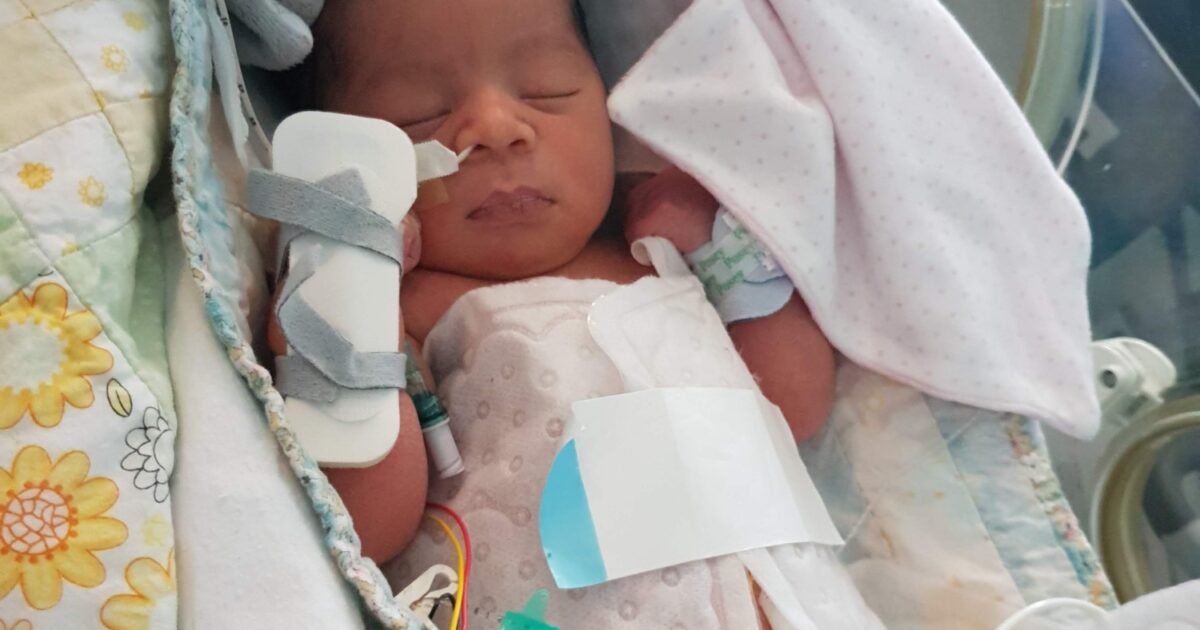 “No one really tells you about full-term babies being born so poorly or ...