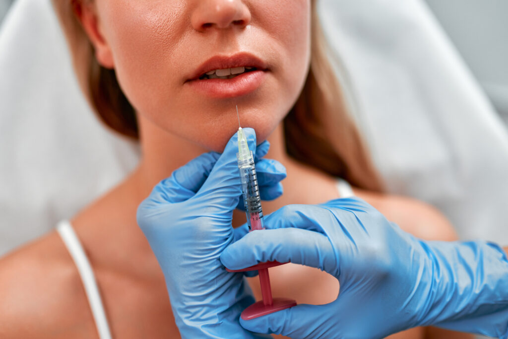 What is Skinfill Bacio? | Refine Pharma