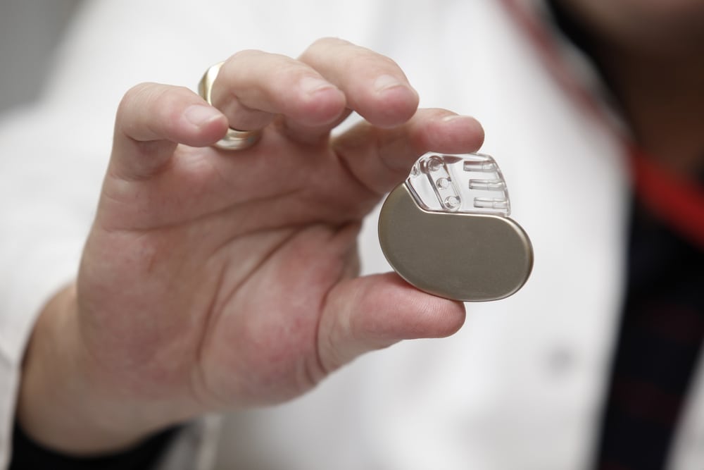 St. Jude acquires world’s only leadless pacemaker - Merlin