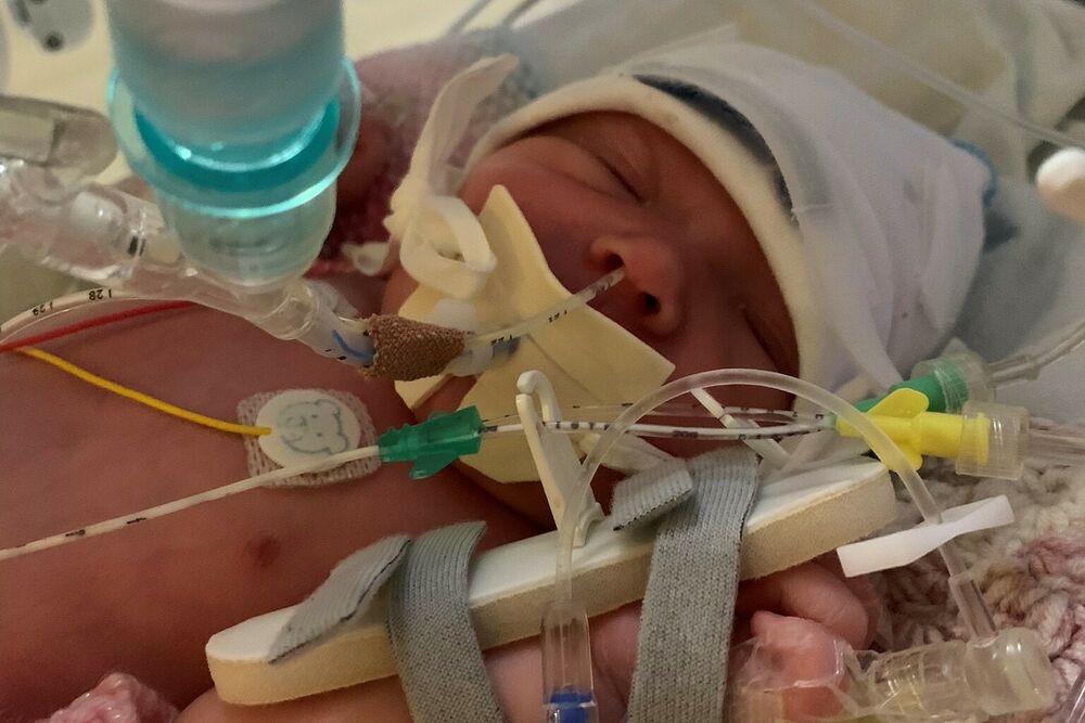 How NICU accommodation made the world of difference to my baby’s ...