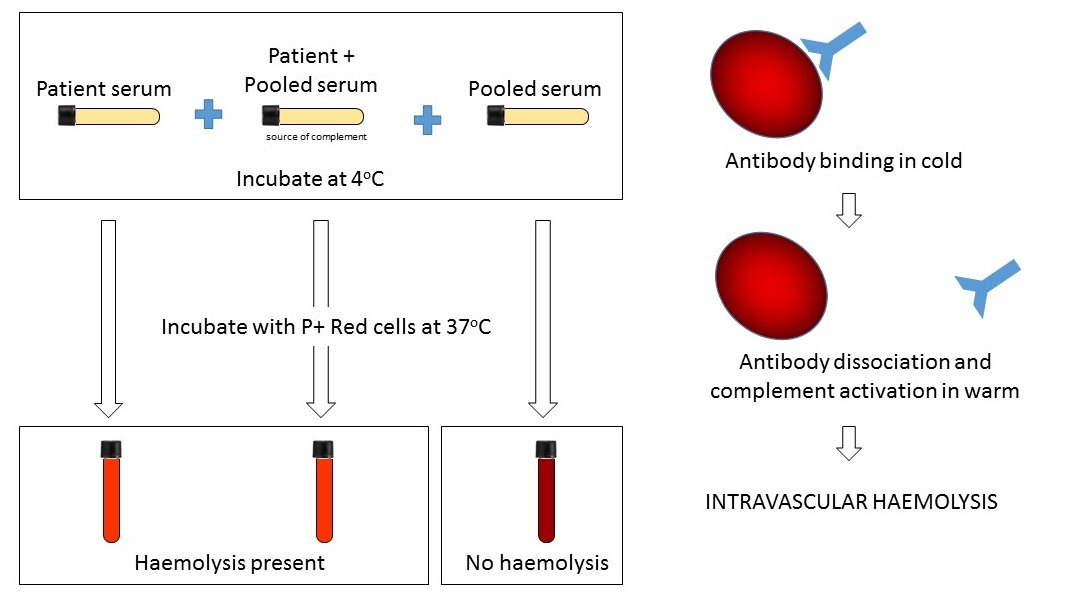 Donath-Landsteiner test method for paroxysmal cold haemoglobinuria ...